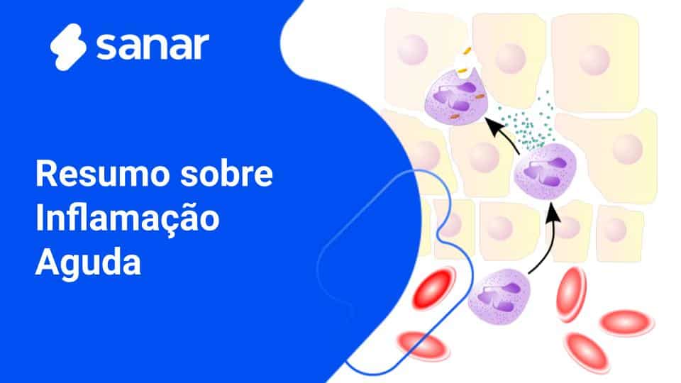 Resumo sobre inflamação aguda: componentes, sinais e sintomas e mais ...