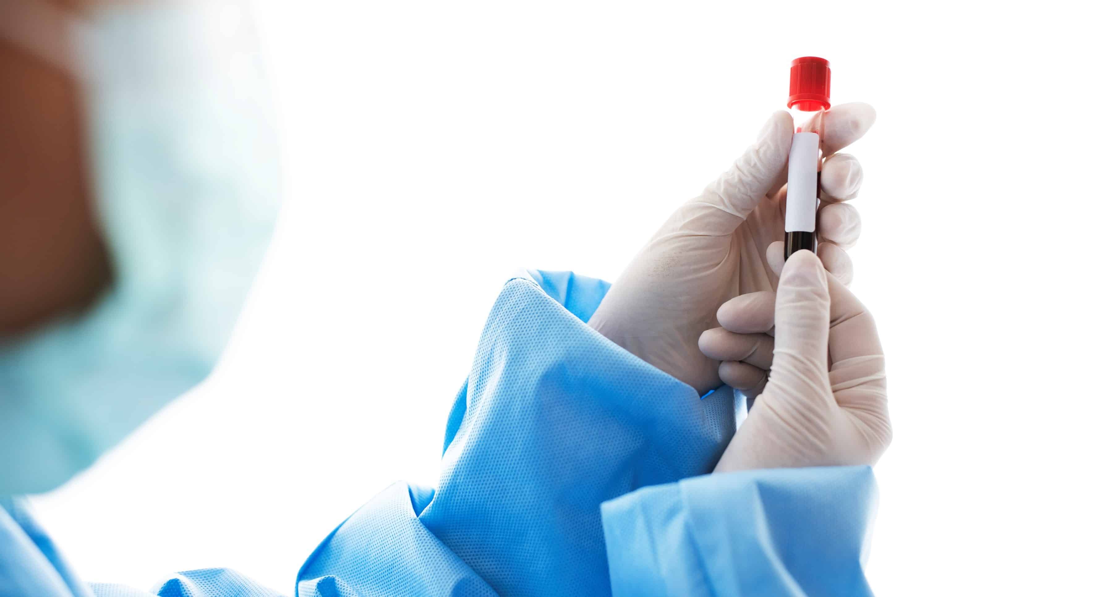 Proteína C-Reativa (PCR): o que preciso saber na prática?