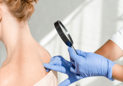 Eritrasma: sinais, diagnóstico e tratamento - Sanarmed