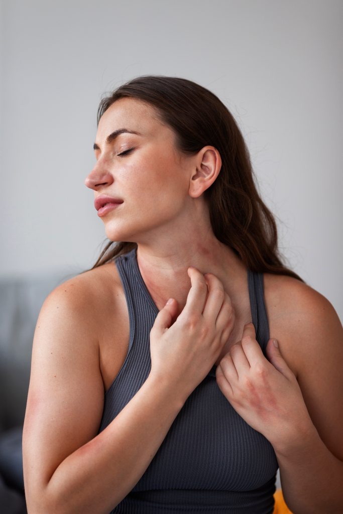 Prurido crônico Sanarmed